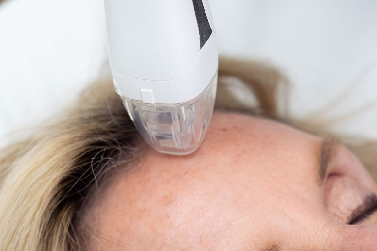 Skin Laxity and Sagging Treatments | Tallahassee